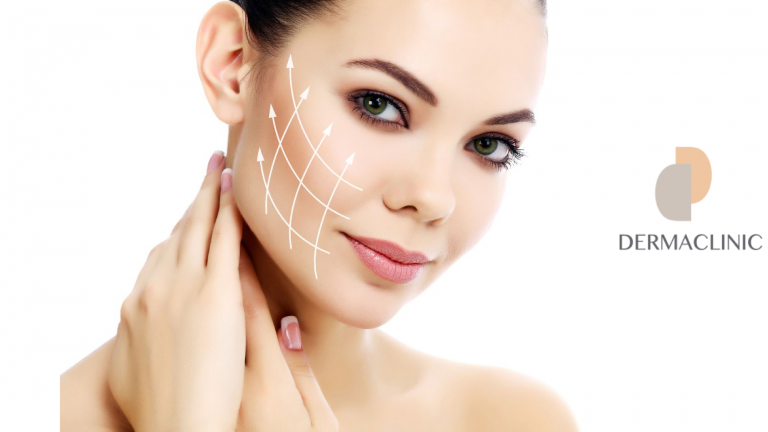 Lifting με νήματα - DermaClinic - Δερματολόγος - Ιωάννινα